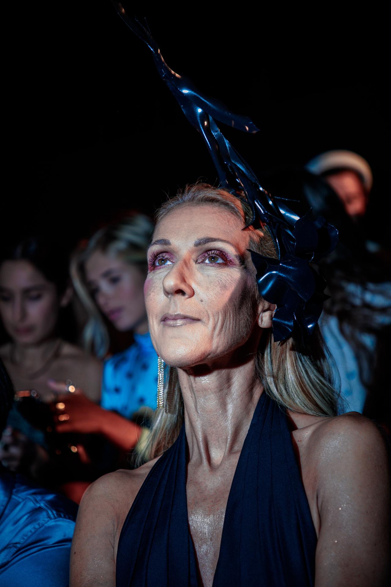 Céline Dion revela síndrome de la persona rígida | Qué Pasa