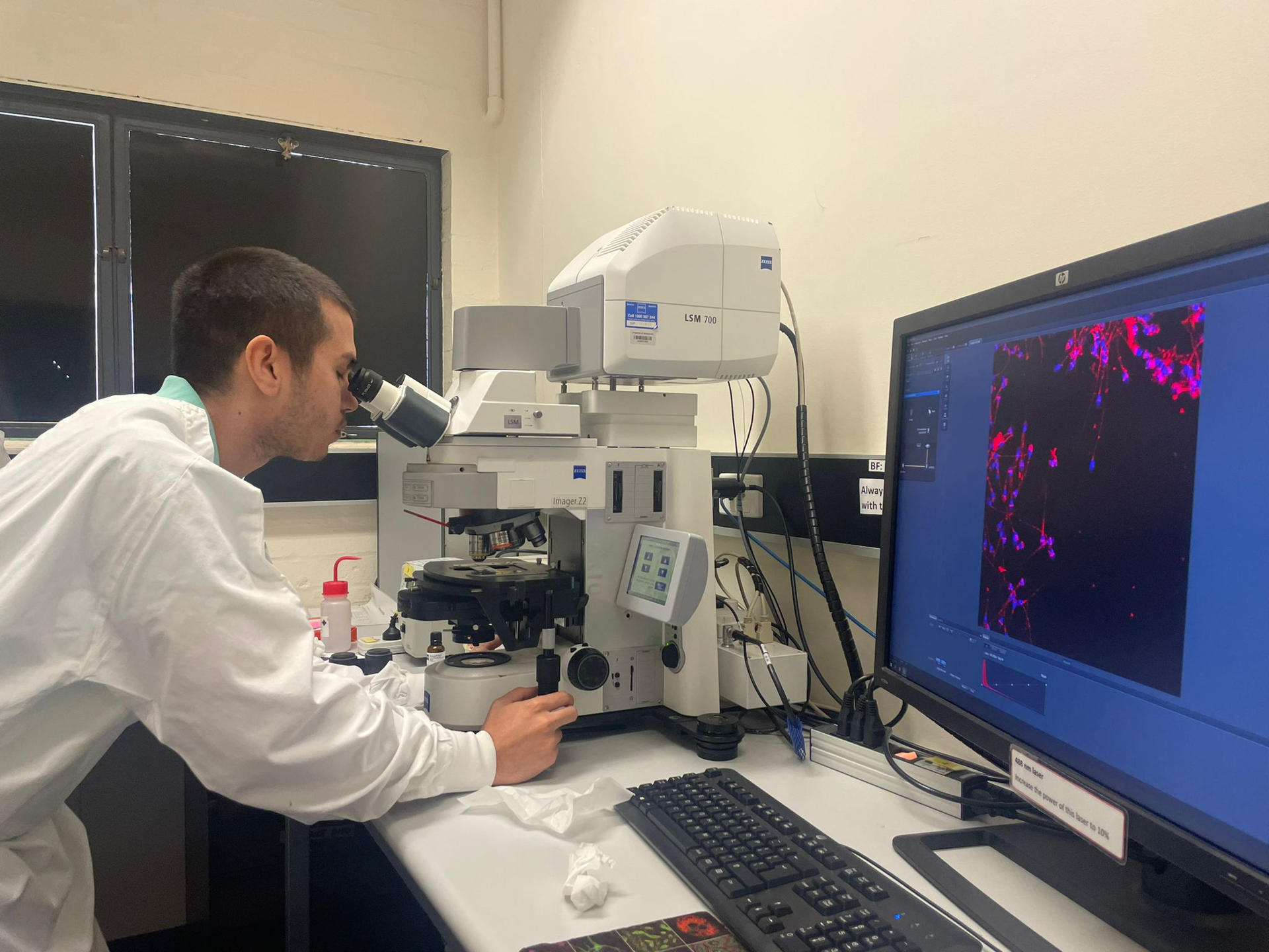 Científicos crean embrión de canguro "in vitro", lo que ayudaría a ...