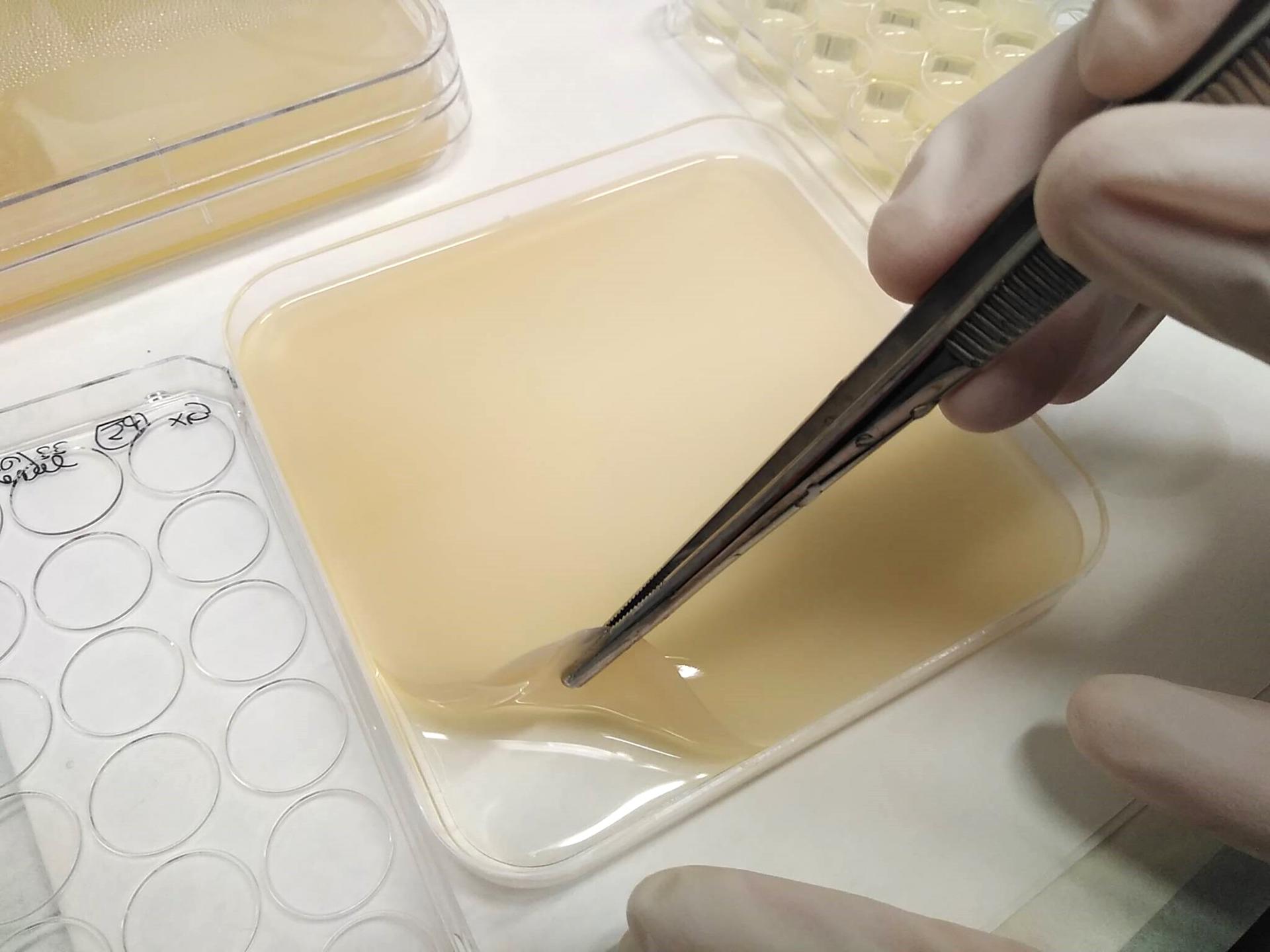 La celulosa bacteriana favorece la regeneración de los tejidos ...